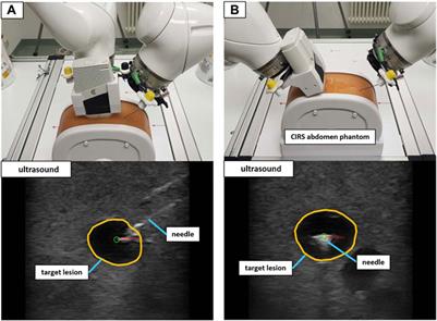 Frontiers | Design and validation of a medical robotic device system to control two ...